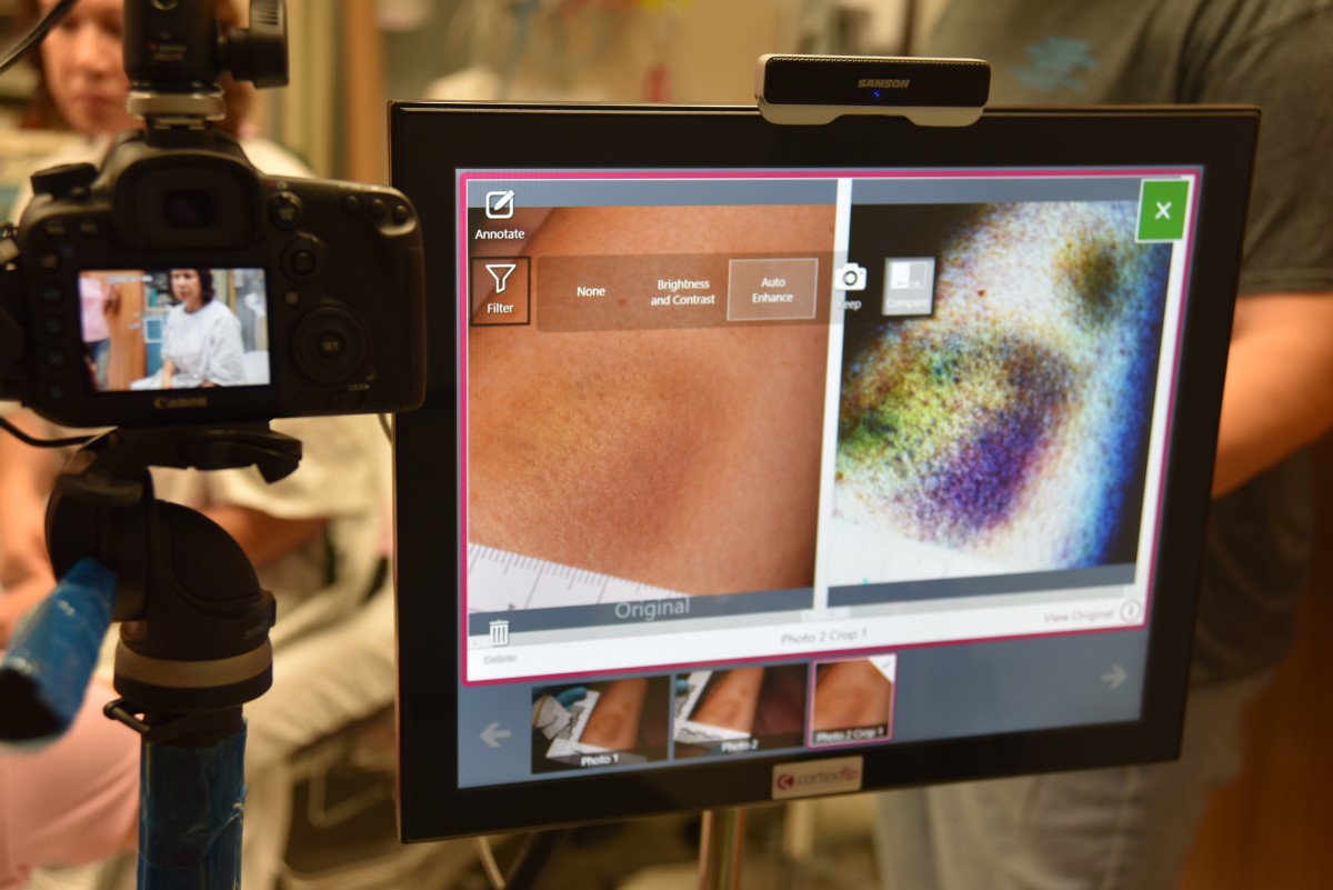 Technology helps better document sexual assault injuries | Article ...