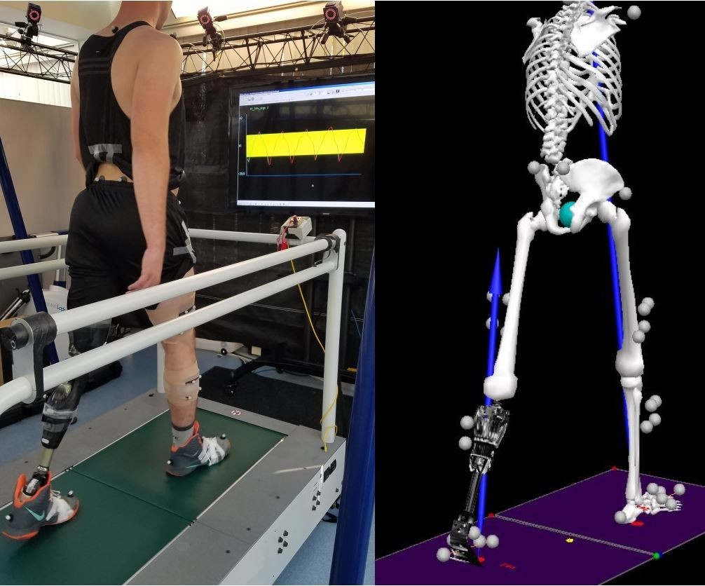 Army Medicine designated lead in extremity trauma treatment | Article ...