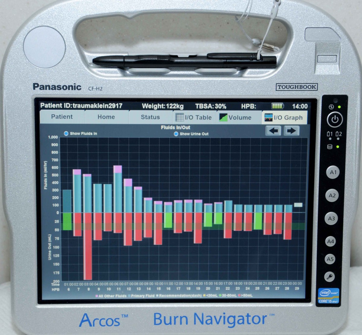 Burn Center continues excellence with both old and new technologies ...